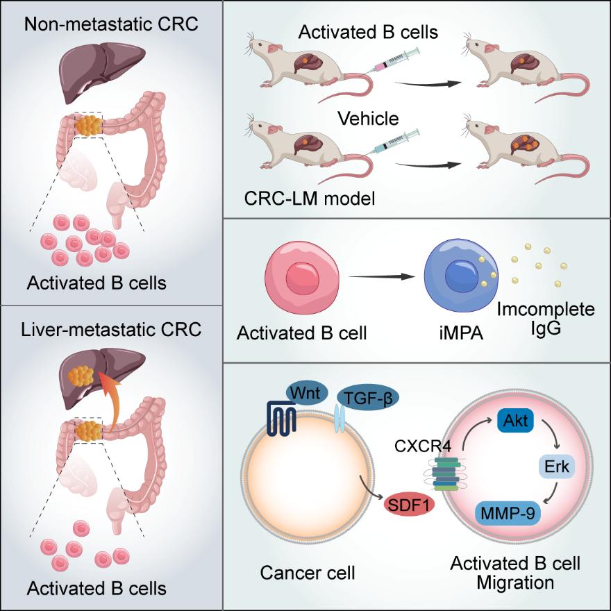 Cell Reports: 基础医学院药理学系朱棣、附属中山医院许剑民联合团队揭示结肠癌肝转移机制